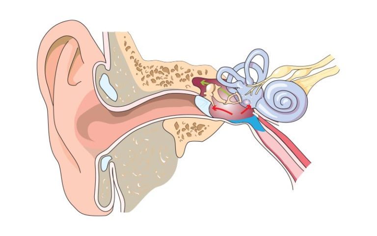 How to Deal with Other Ear Problems - Divers Alert Network