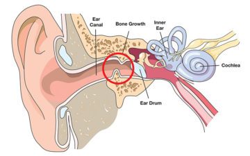 Chapter 2: Injuries - Divers Alert Network