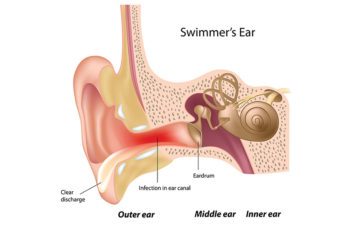Chapter 2: Injuries - Divers Alert Network