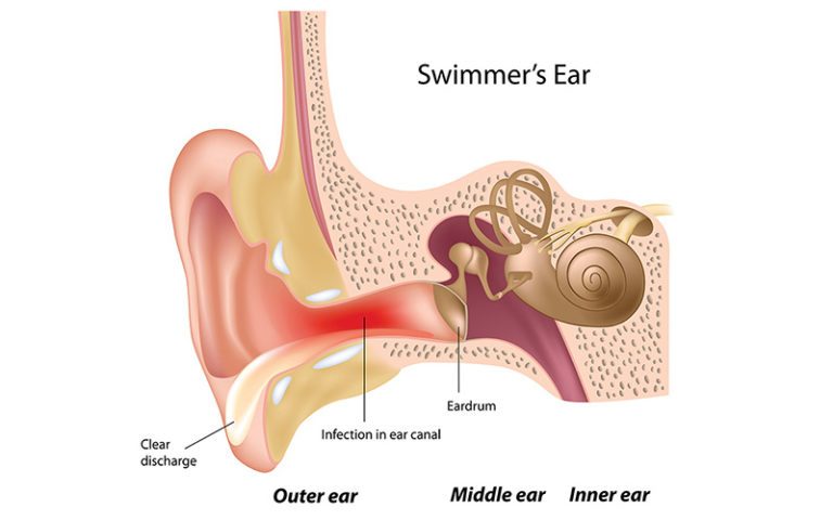 Chapter 2: Injuries - Divers Alert Network